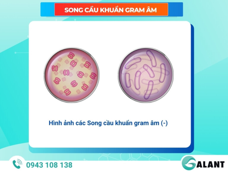 Song Cầu Khuẩn Gram Âm: Dấu Hiệu, Chẩn Đoán Và Điều Trị - Galant
