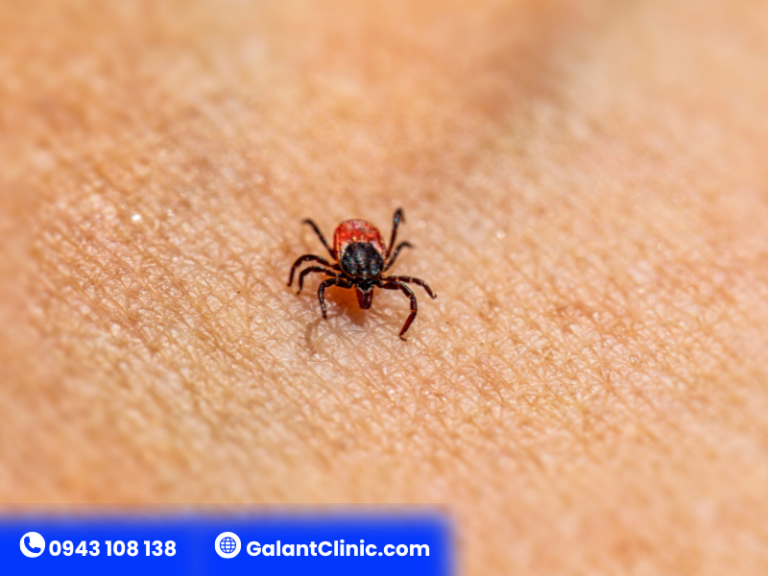 Ký Sinh Trùng Là Gì? Có Lây Từ Người Sang Người Không? - Galant