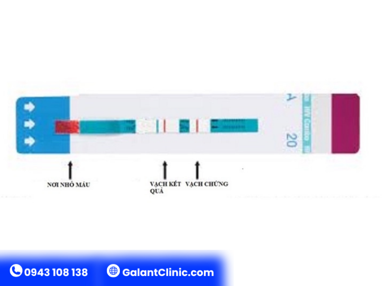 Que Test HIV Alere Combo Có Chính Xác Không? - Galant